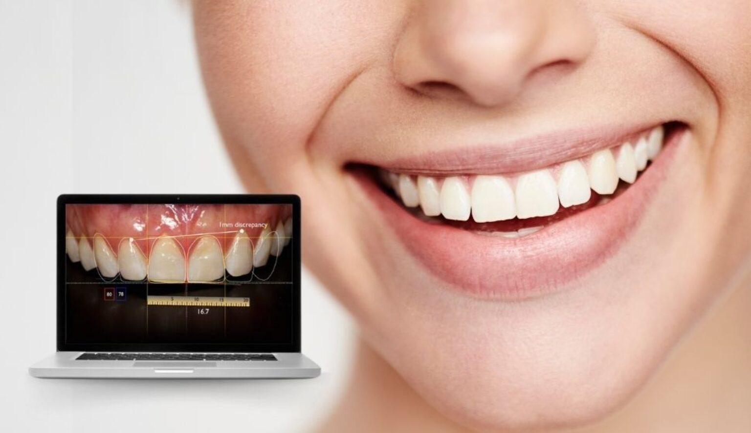 Digital Smile Designing: Enhancing Functional Aspects of Your Smile ...
