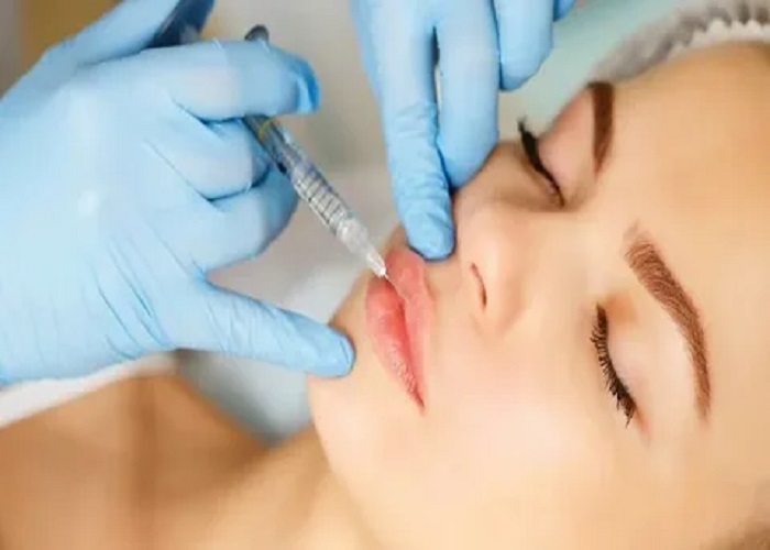 The Rise of Lip Fillers in Riyadh: A Comprehensive Guide - ezine articles