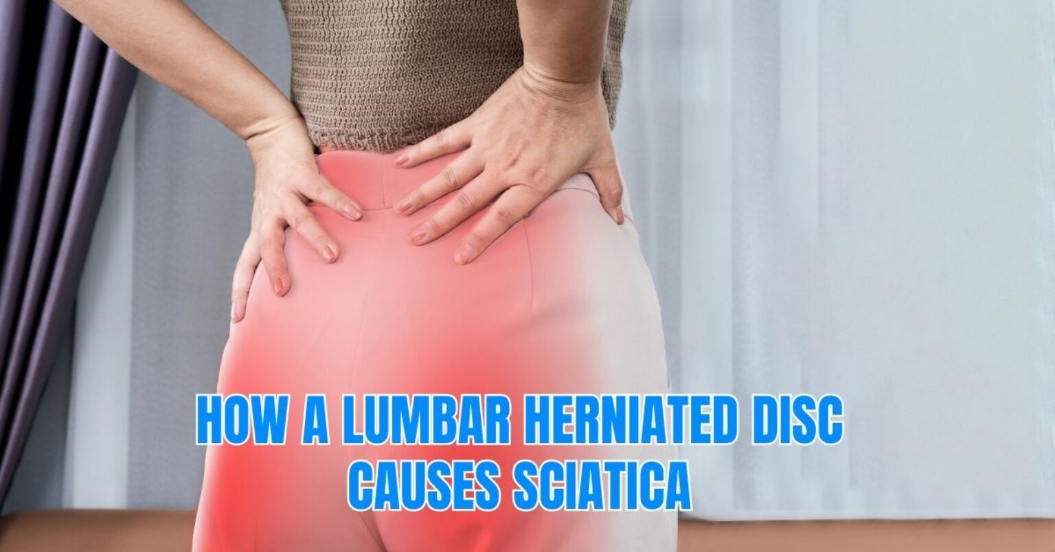 How Does a Lumbar Herniated Disc Cause Sciatica? - ezine articles