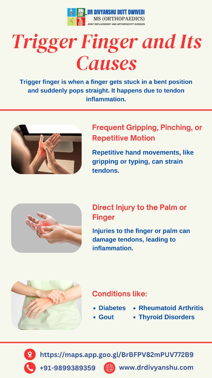 Trigger Finger and It’s Causes: What You Need to Know - ezine articles
