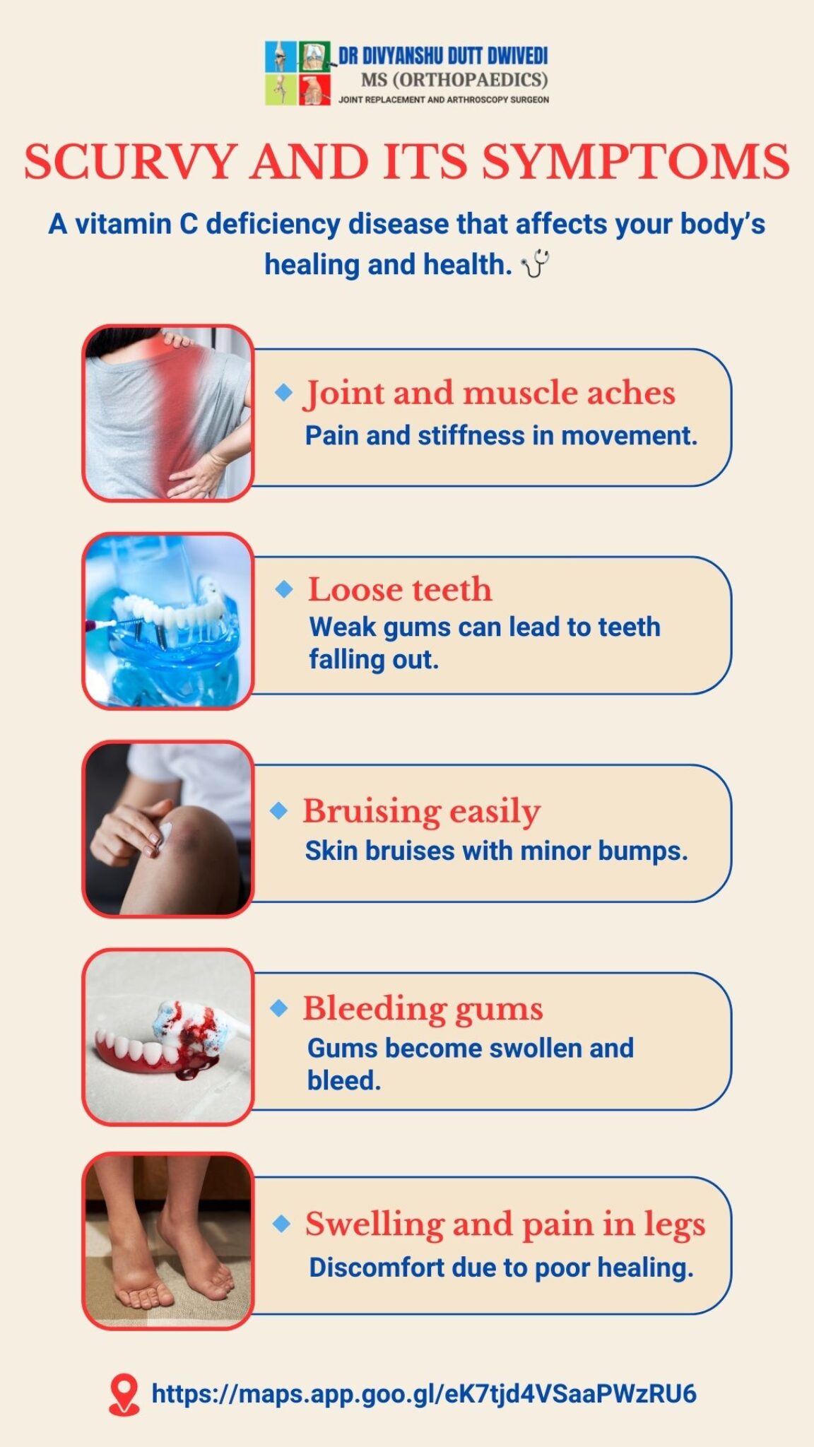 Scurvy: Symptoms You Should Know! 🍊🩺 - ezine articles