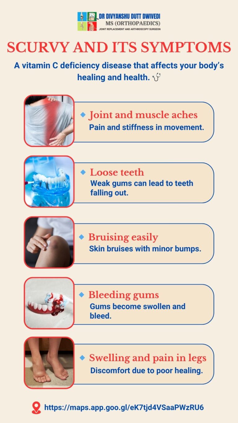 Scurvy: Symptoms You Should Know! 🍊🩺 - ezine articles