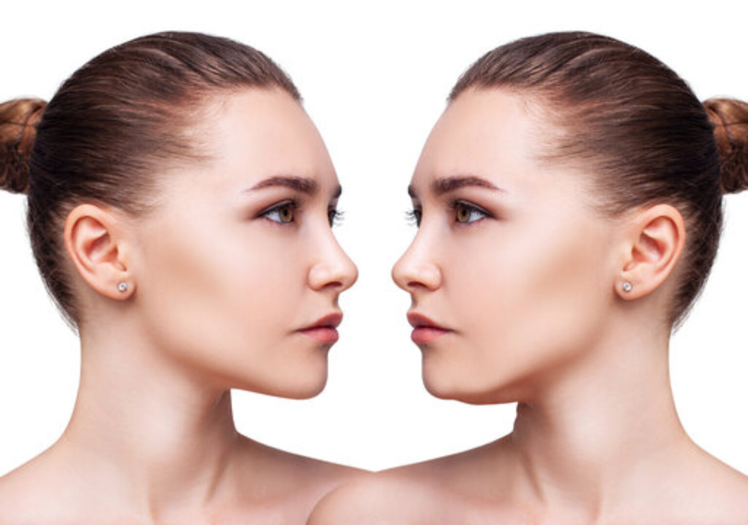 How Effective Is Double Chin Liposuction for Slim Faces? - ezine articles