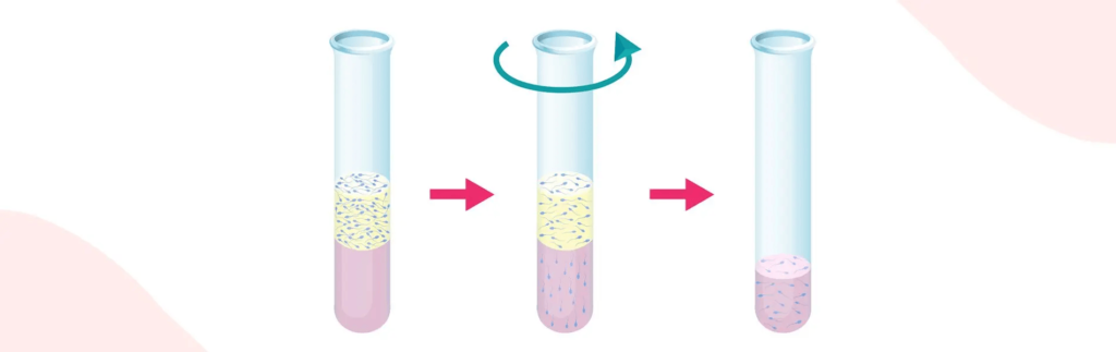Double Density Gradient Centrifugation — How It Impacts Sperm Quality ...