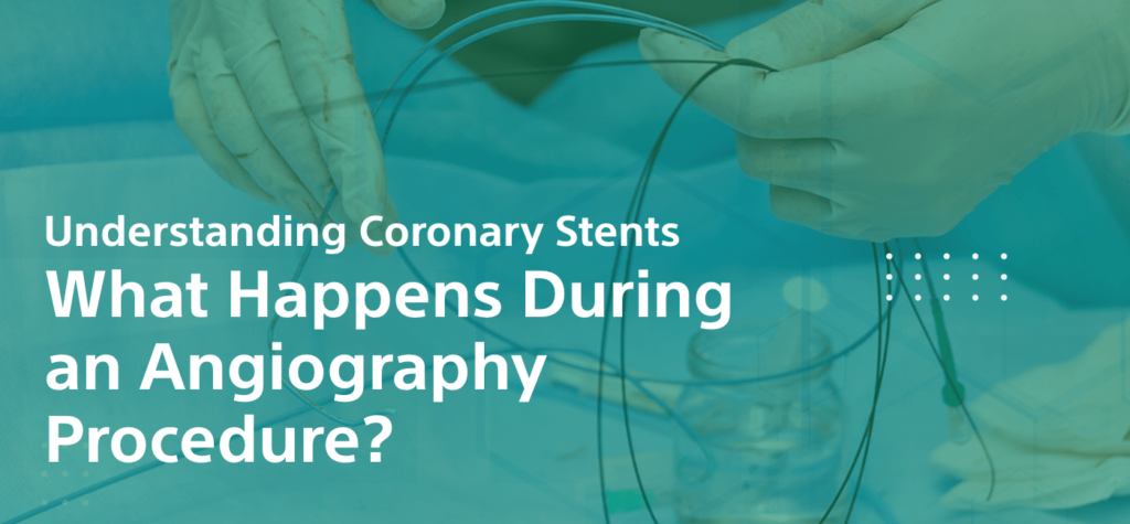 What Happens During an Angiography Procedure? Understanding Coronary ...